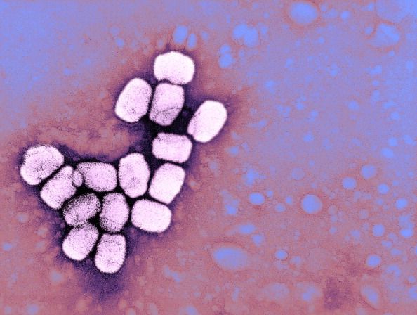 Explosion Hits Russian Virus Research Center That Houses Smallpox and ...