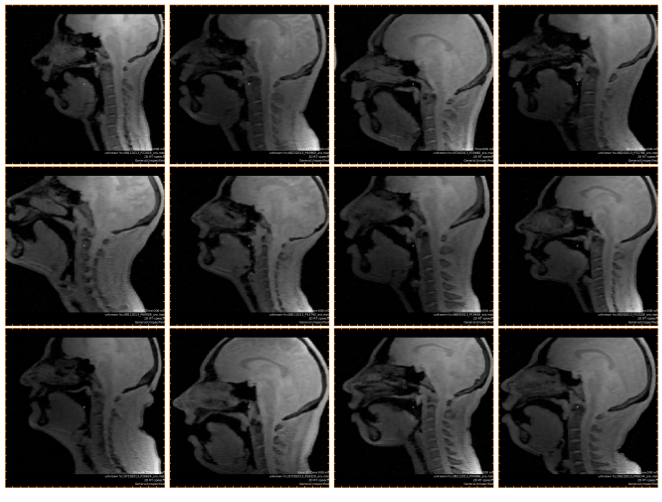 Watch: Bizarre MRI Video Shows How Beatboxers Make Sounds - Newsweek