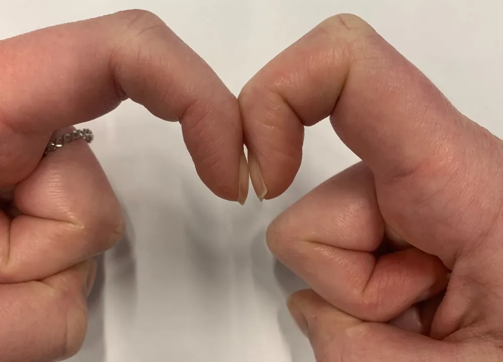 This Simple Finger Test Could Reveal Signs of Lung Cancer and Other ...
