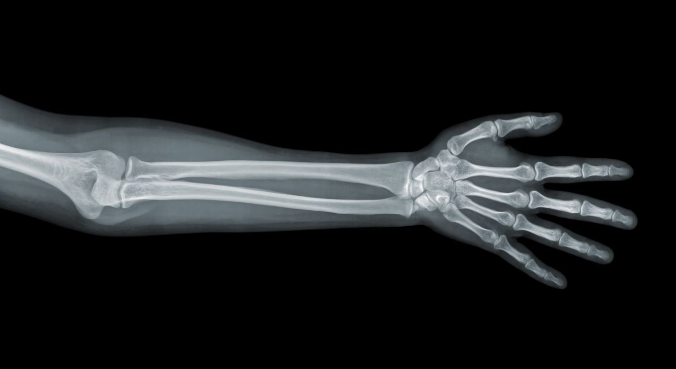 Man Has Amputated Arm Preserved by Taxidermist - Newsweek