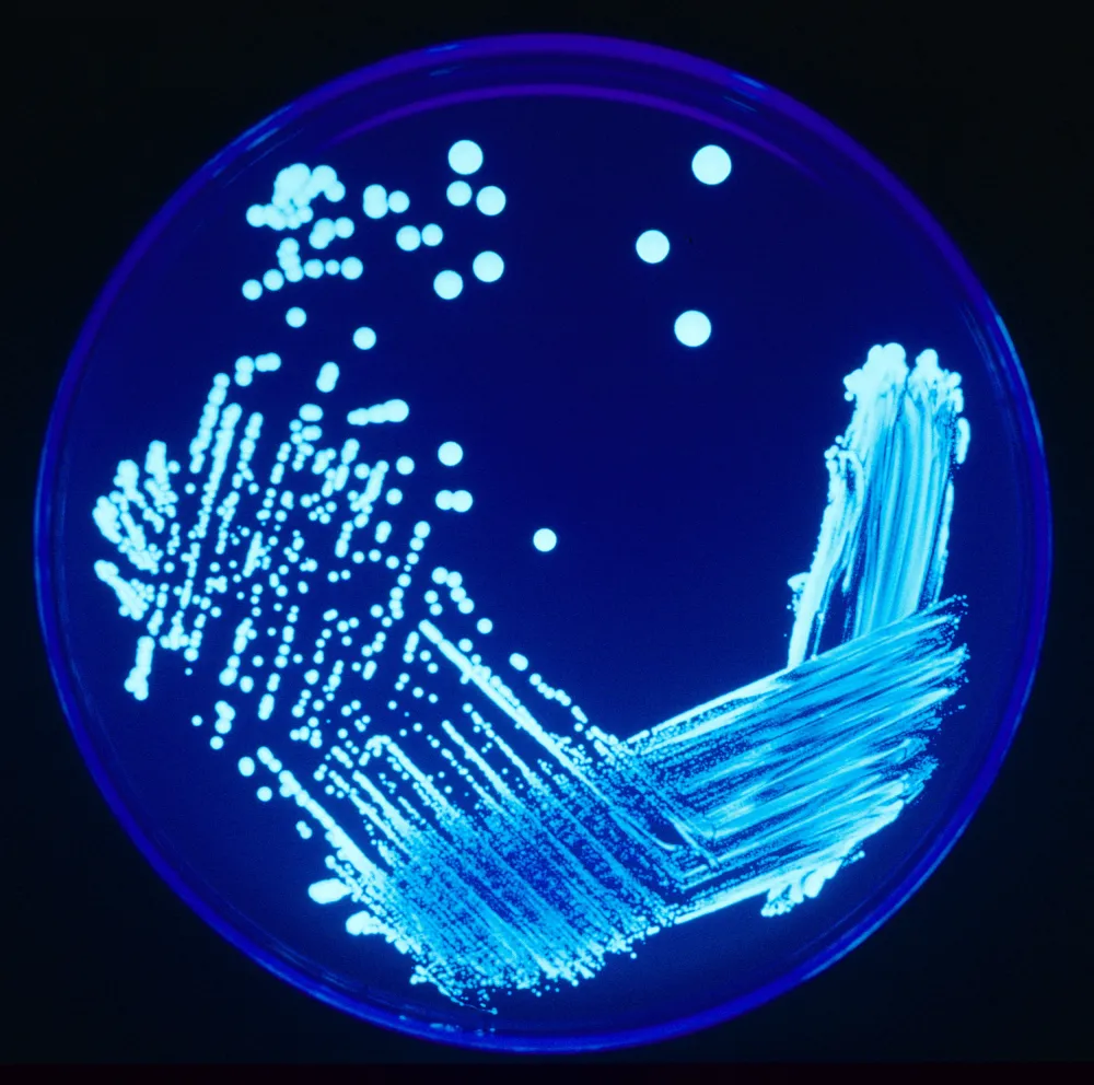 Legionnaires' Disease News & Latest Pictures From Newsweek.com