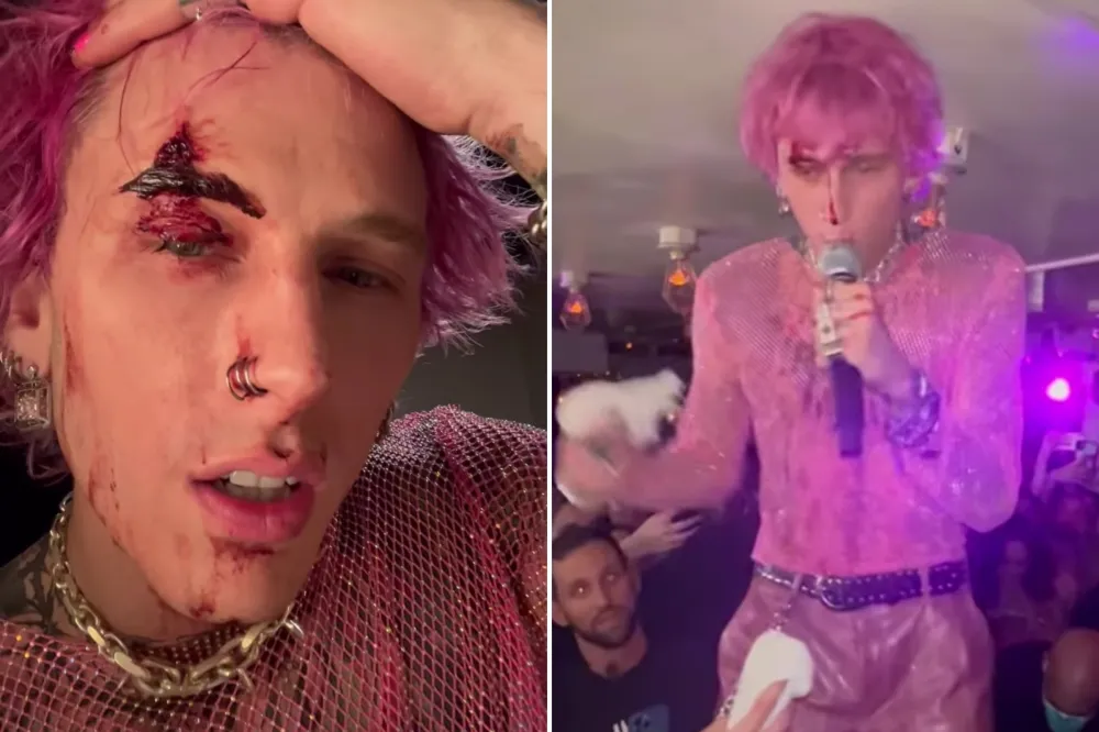 MGK Shows Bloody Injury After Smashing Glass On His Face During ...