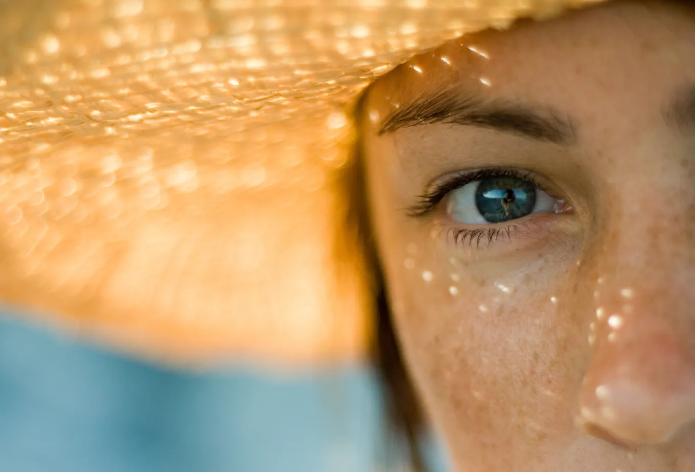 Freckle Trend Is Back as Woman Goes Viral for Hiding Pimple: ‘Can You ...