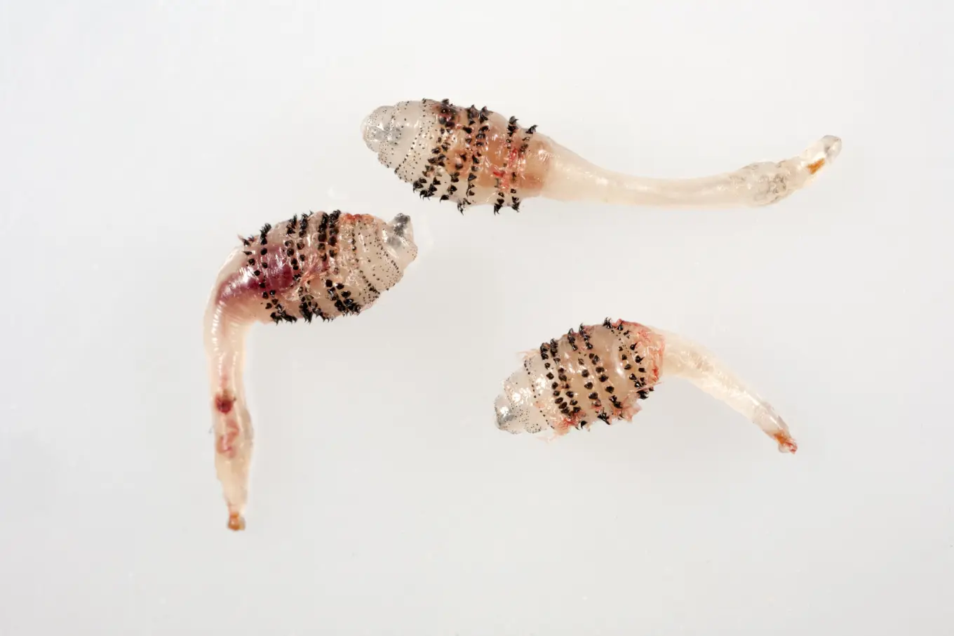 Woman Had White Maggots Covered in Black Dots Living in Arm for Months ...