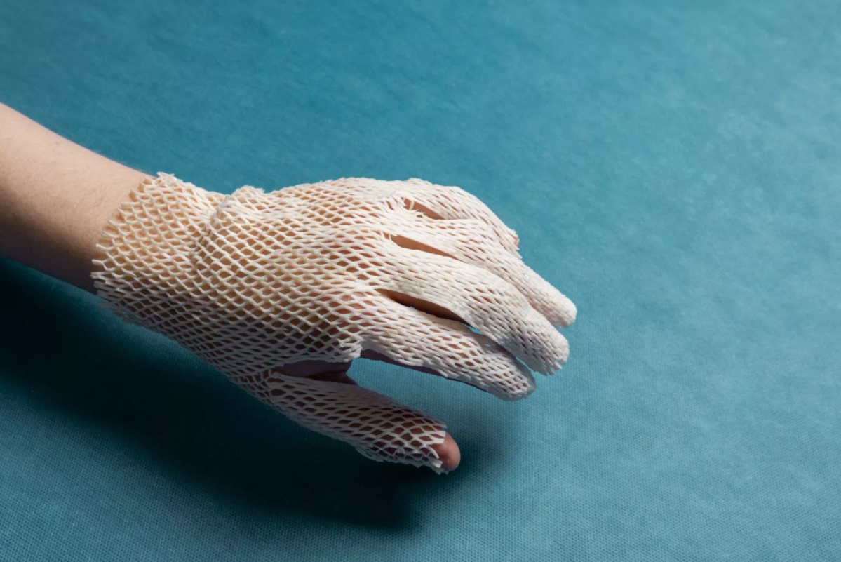 How Fish Skin is Being Used to Treat Burn Victims - Newsweek