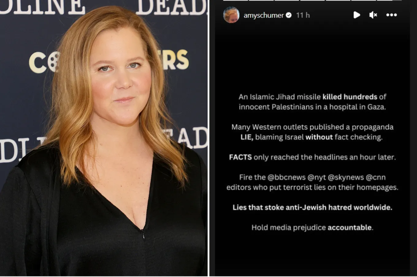 Amy Schumer Is Getting Canceled - Newsweek