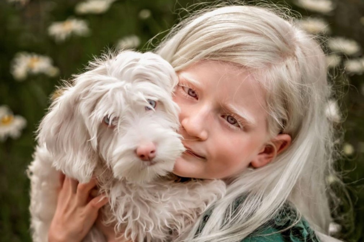 Mom Shares How She Helps ‘Fighter’ Daughter With Albinism Tackle Stigma ...