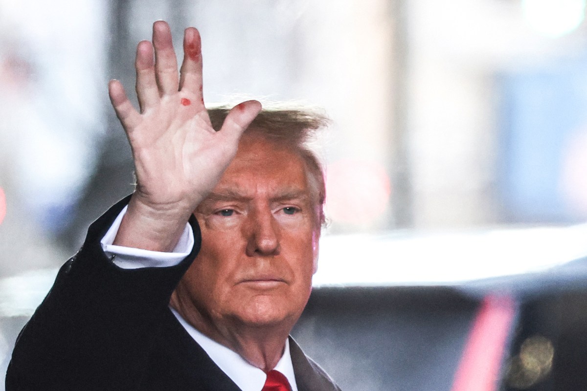 Donald Trump’s Red-Spotted Hand in Photo Sparks Speculation - Newsweek