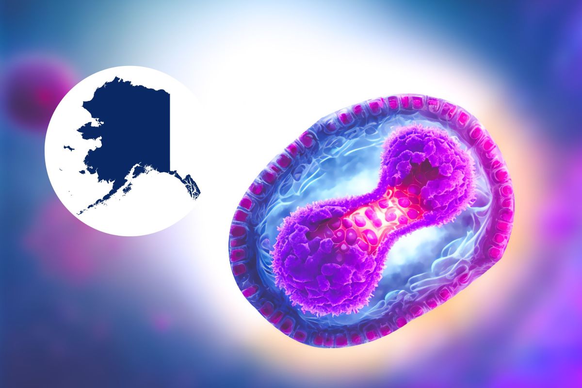 Alaskapox Death Means Virus ‘More Geographically Widespre... - Newsweek
