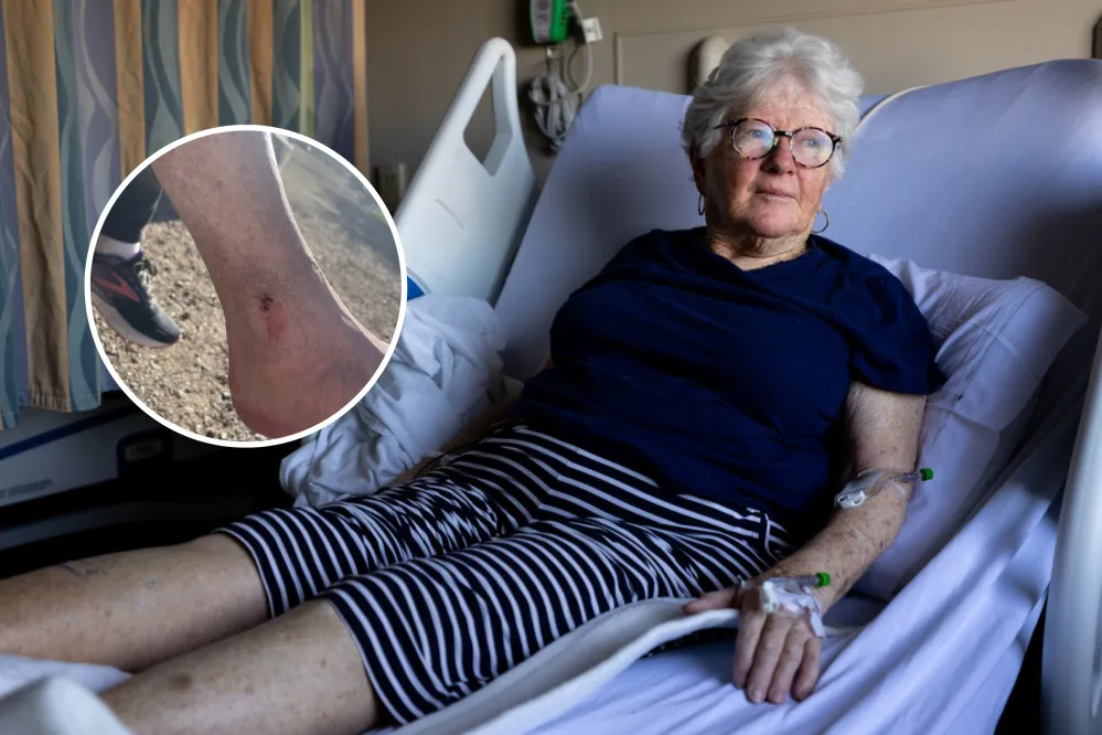 Snake bite News & Latest Pictures From Newsweek.com