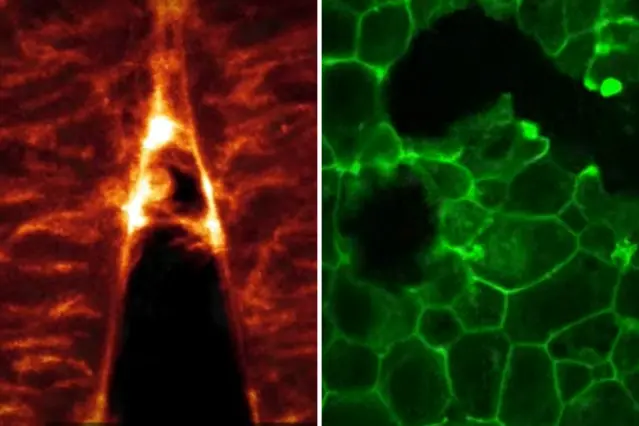 Watch First Real-Time Video of Growing Embryo - Newsweek