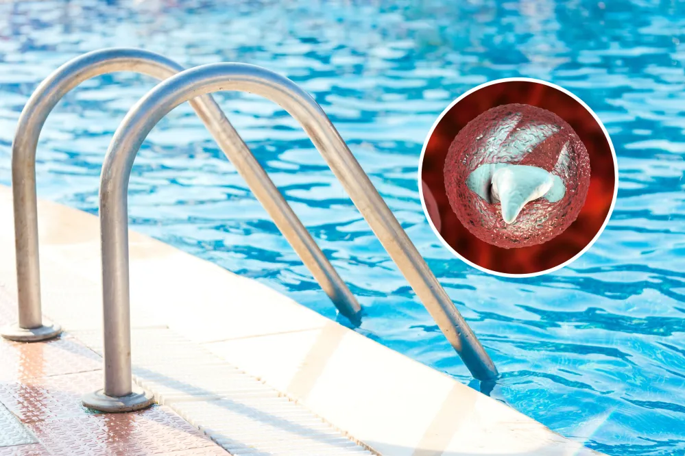Warning As ‘Nasty’ Parasite Infests Kentucky Pools: ‘Wash. Your. Hands ...