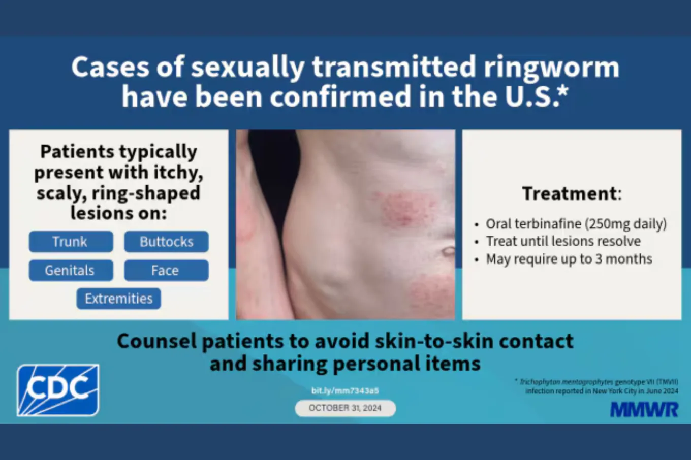 CDC Warning Over Genital Fungus ‘Emerging’ in New York City - Newsweek