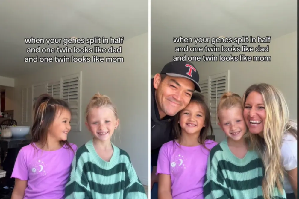 Couple Have Twins, No One Prepared for How They Look After ‘Genes Split ...