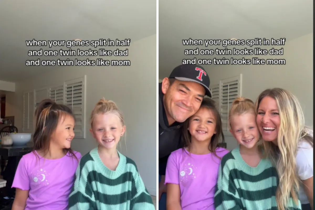 Couple Have Twins, No One Prepared for How They Look After ‘Genes Split ...