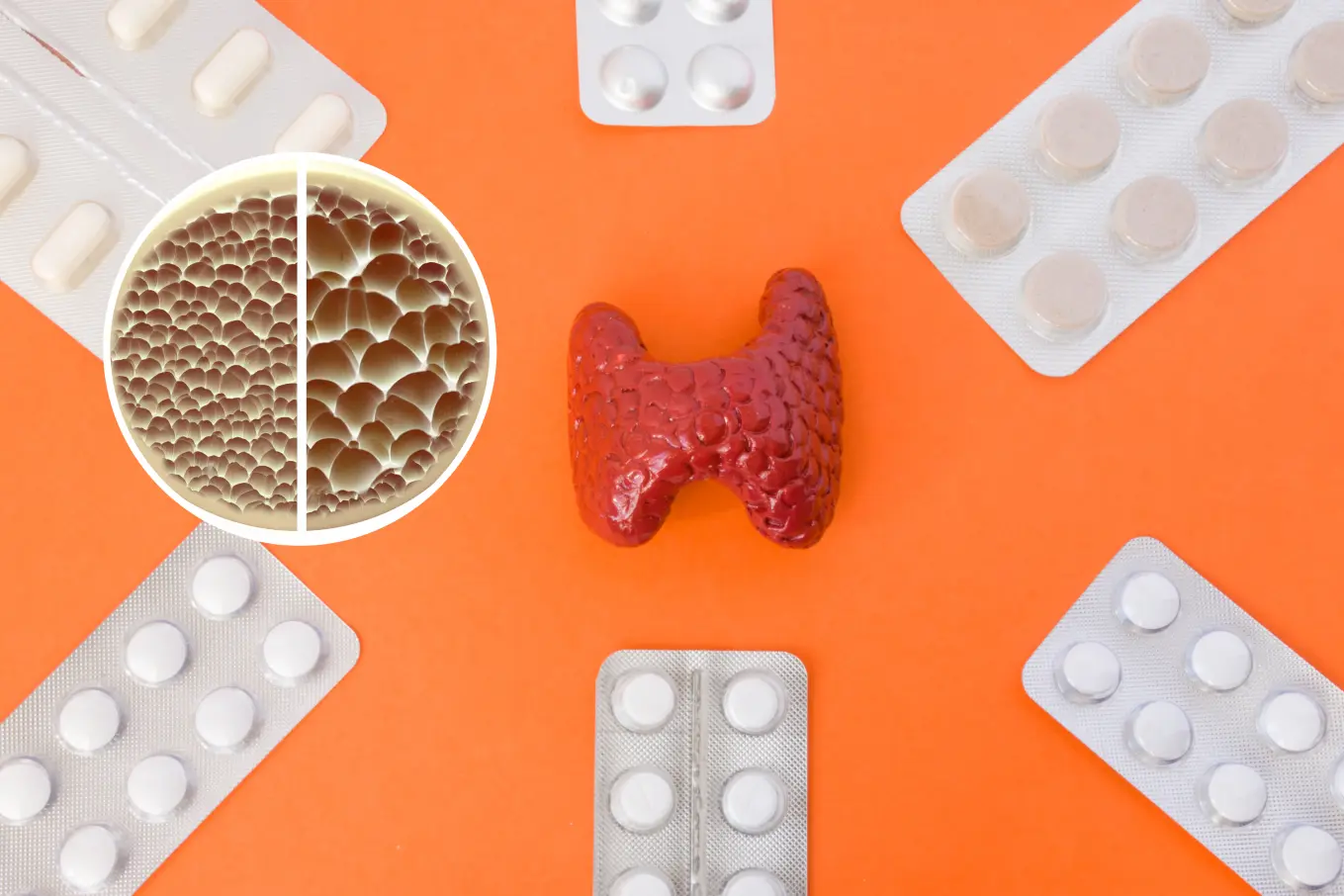 Thyroid Medication and Bone Loss: Everything You Need To Know - Newsweek