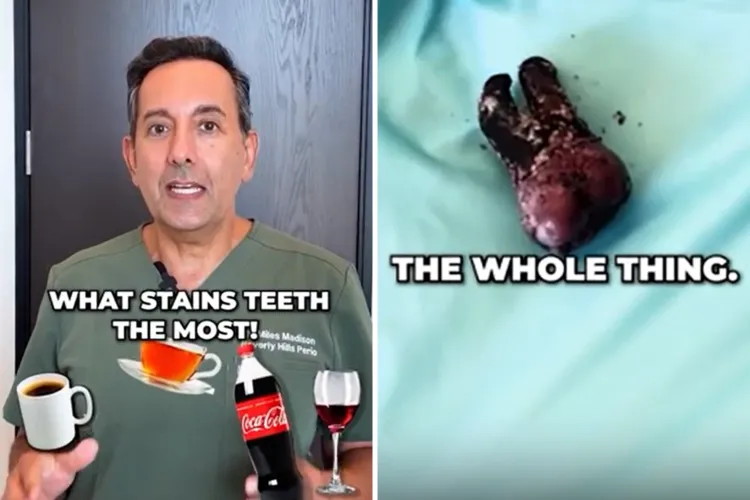 Shock As Dentist Reveals Which Drink Stains Your Teeth the Most - Newsweek