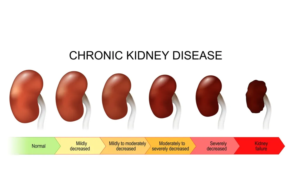 Sleeping Late May Increase Risk of Death, Study Warns - Newsweek