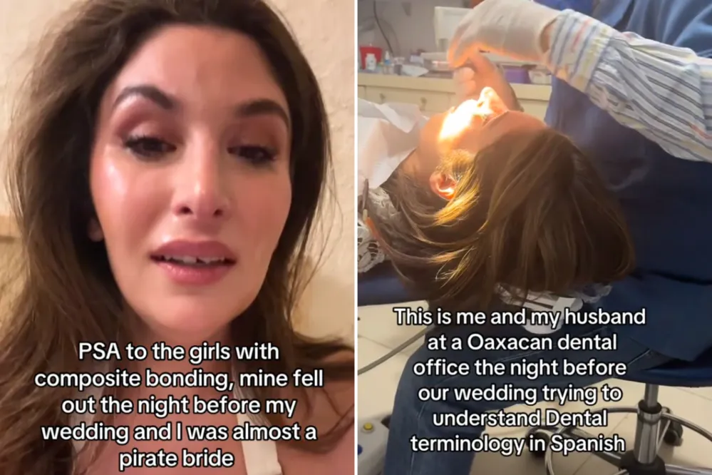 Bride-To-Be in Tears After Losing Part of Front Tooth Night Before ...