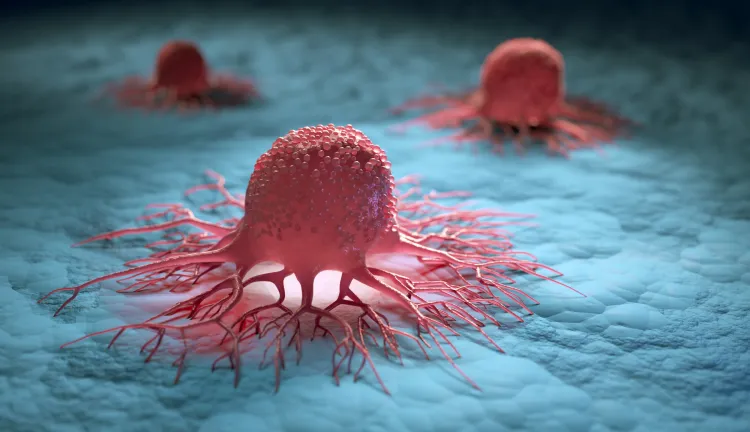 Scientists Discover Way To Reverse Cancer - Newsweek