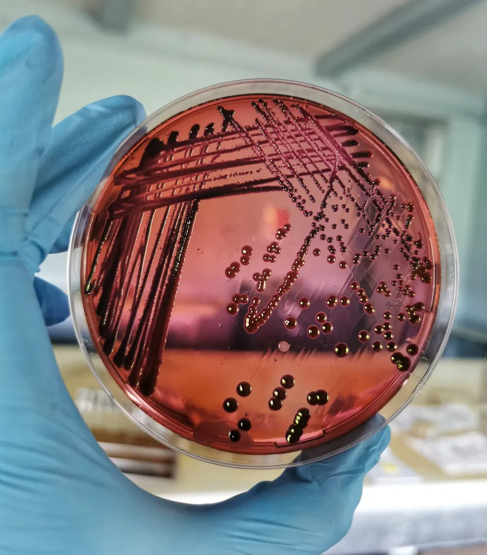 E.coli News & Latest Pictures From Newsweek.com