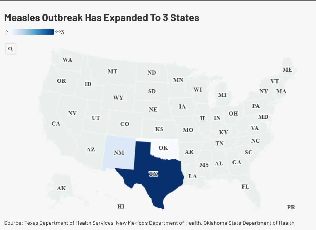 Map Shows Measles Outbreak Has Expanded To 3 States - Newsweek