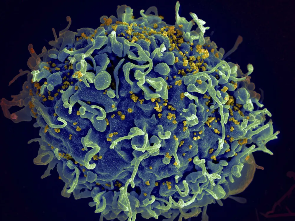 ICE Detainee Dies After HIV Undiagnosed for Months During Custody ...
