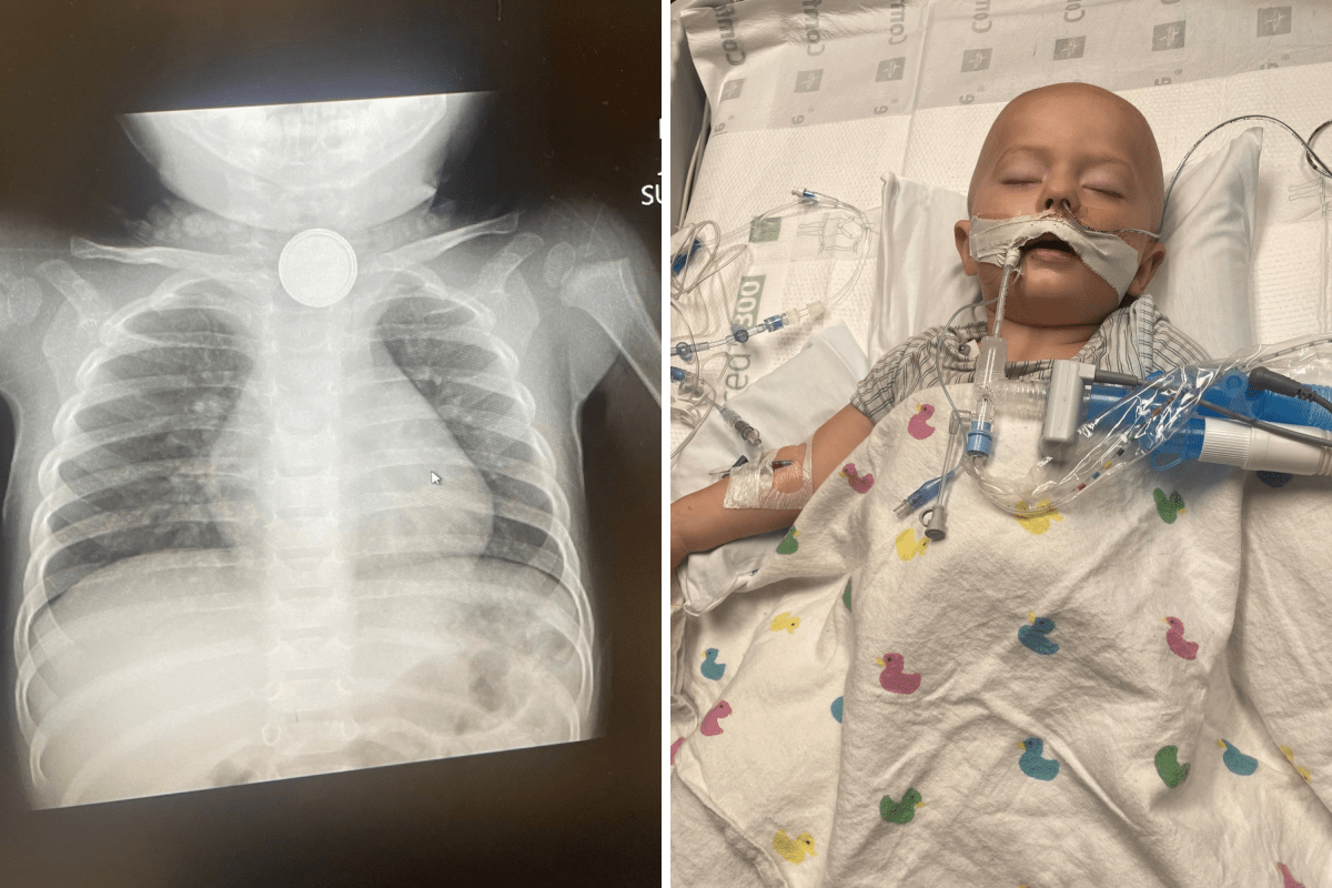 Parents Prepared to Say Goodbye After Toddler Swallows Button Battery ...