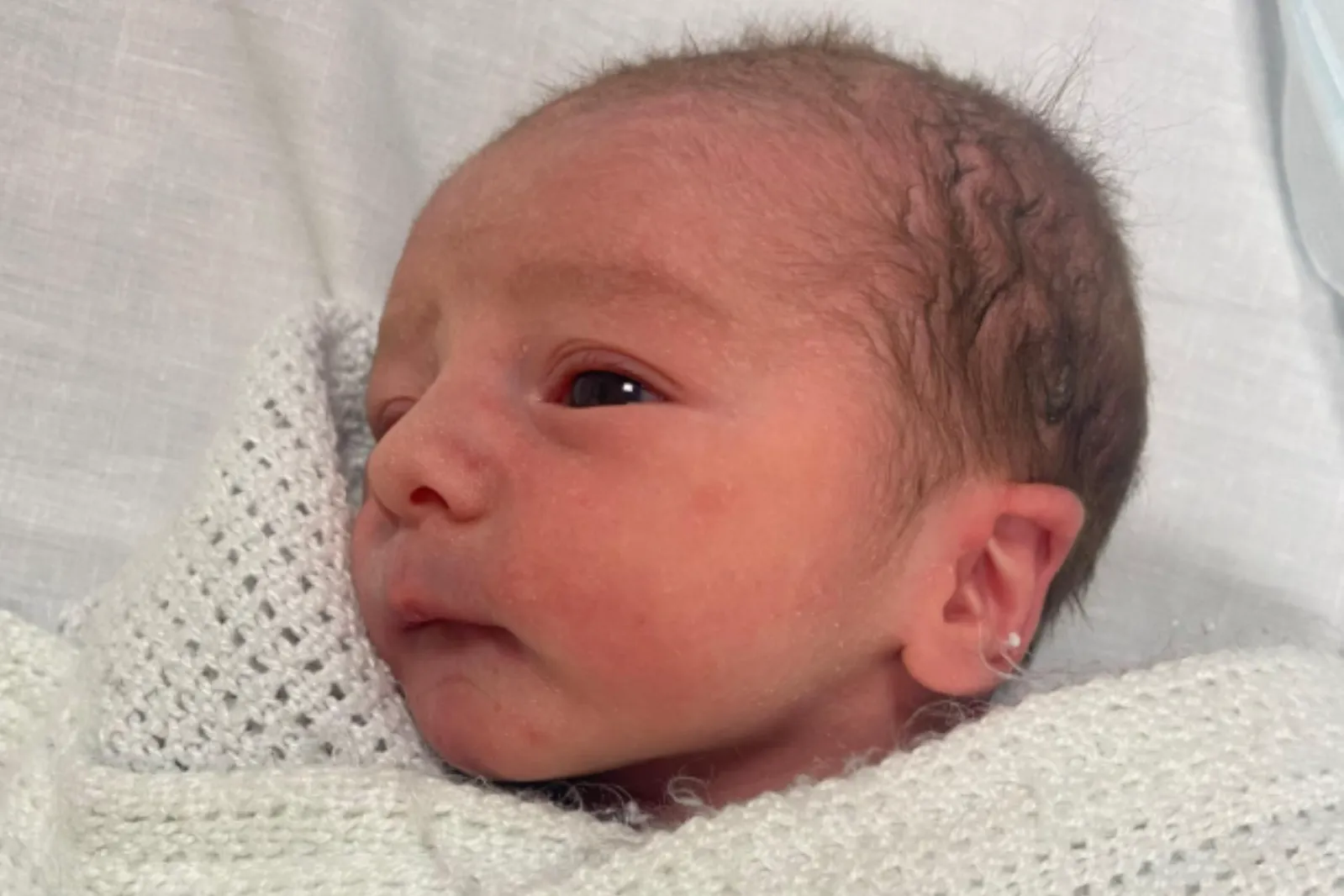 Mom Can’t Cope With How Baby Born With Full Hair Looks Now - Newsweek