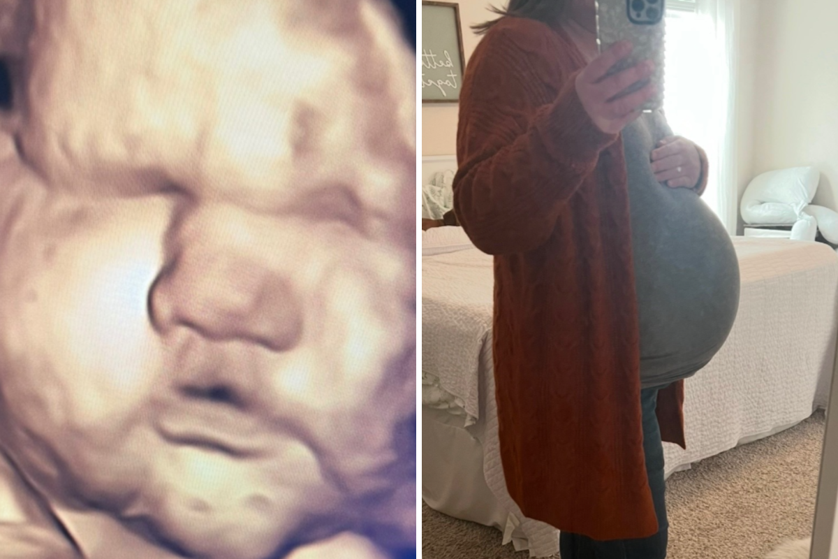 3D Scan Predicted Big Baby—Then She Arrived: ‘Thank Goodness for ...