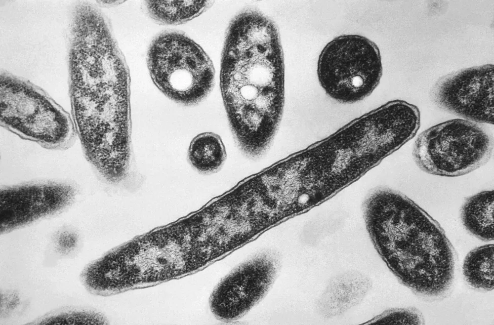 Legionnaires' Disease News & Latest Pictures From Newsweek.com