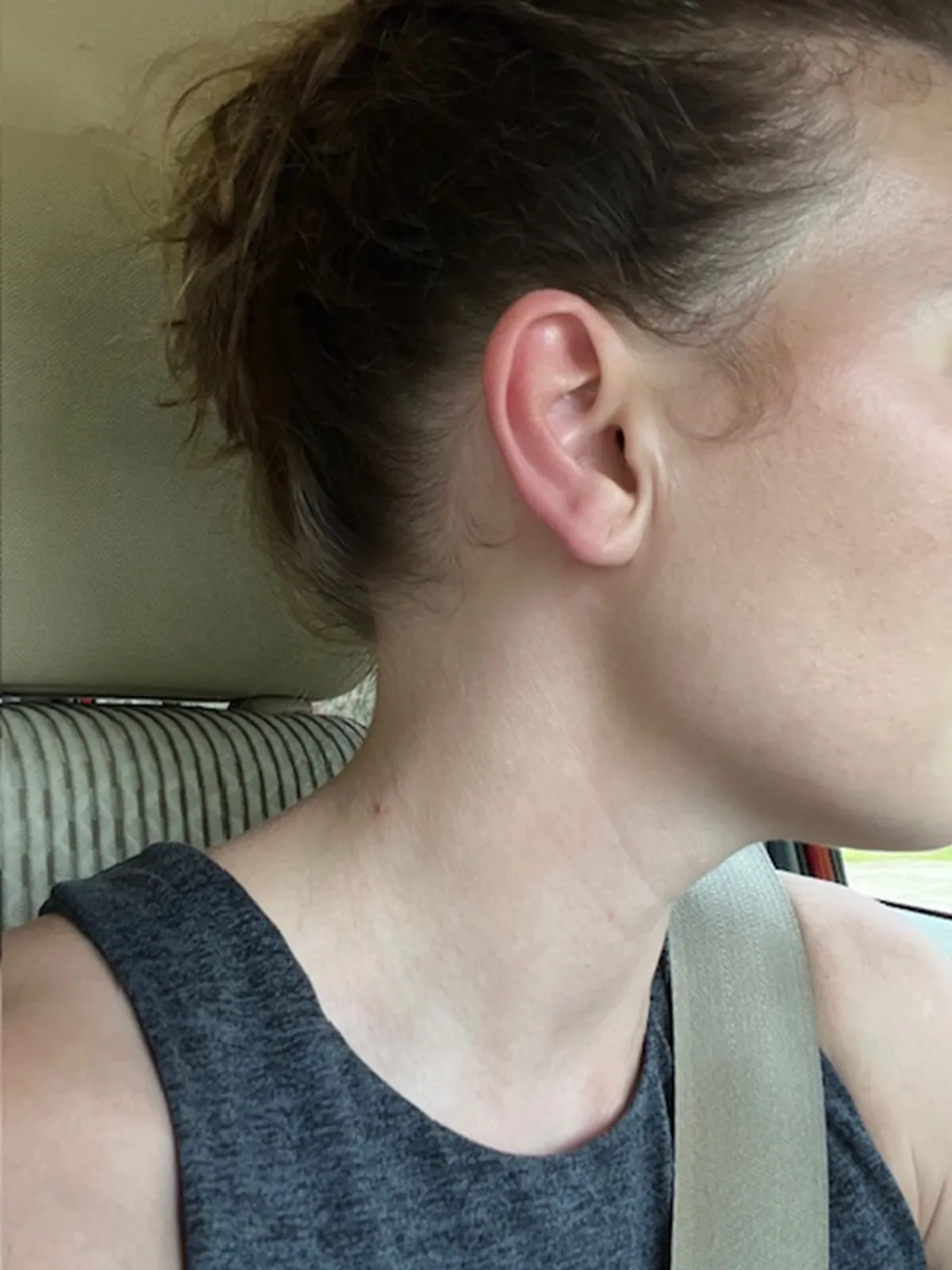 Woman’s Red Ear Leads to Diagnosis After 10 Years of Mystery Symptoms ...