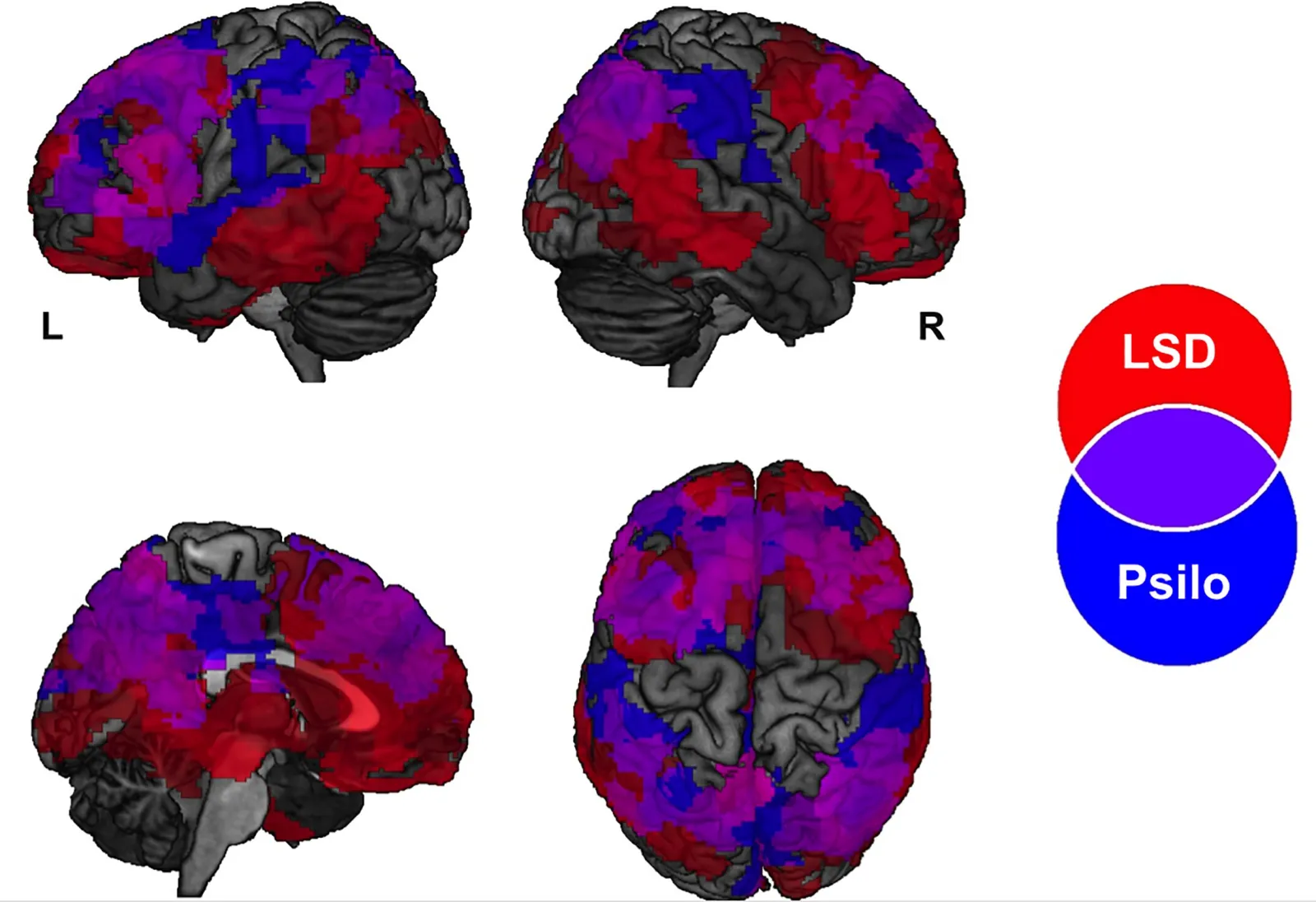 Brain Scans Show Why LSD Makes You Feel One With Nature and Your Self ...