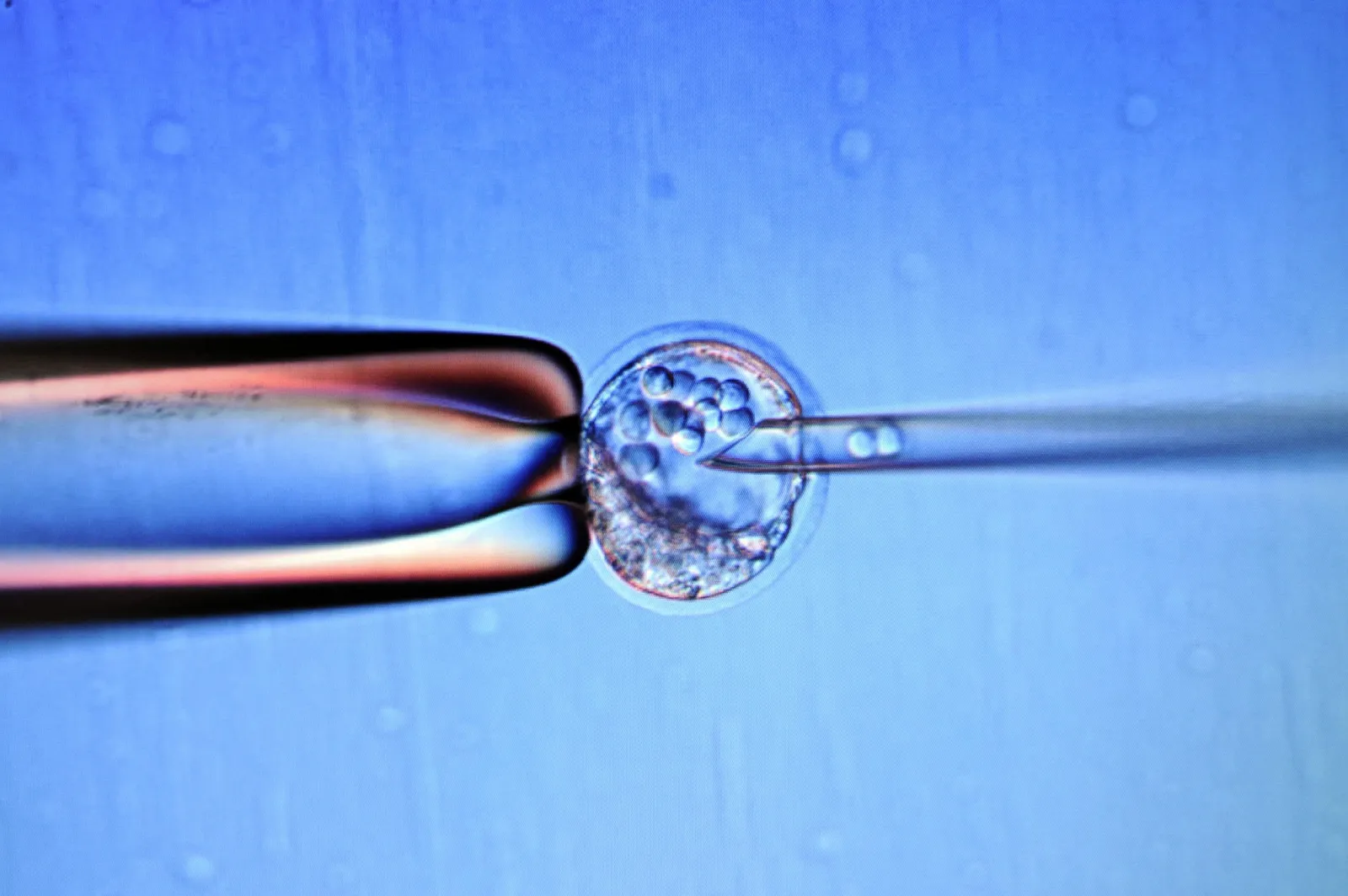 World’s First Baby Born with Three Biological Parents - Newsweek
