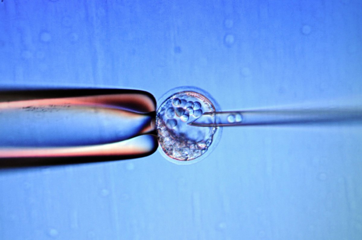 World’s First Baby Born with Three Biological Parents - Newsweek