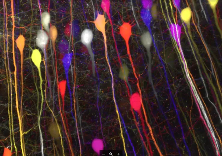 Scientists Armed With Lasers Capture 3D Images of Neurons... - Newsweek