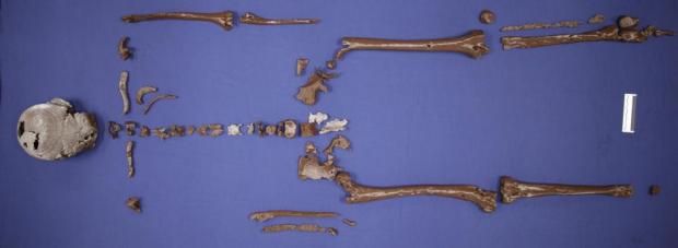 Ancient Skull of Viking King Gorm the Old Reconstructed With 3-D ...