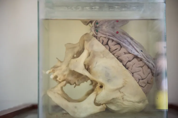 Brain Injuries May Be a Hidden Cause of Criminal Behavior - Newsweek
