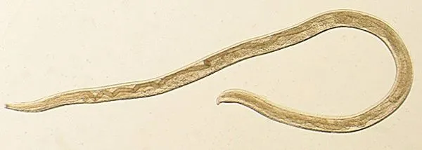 Thelazia Gulosa: Fourteen Worms Removed From Oregon Woman’s Eye in ...