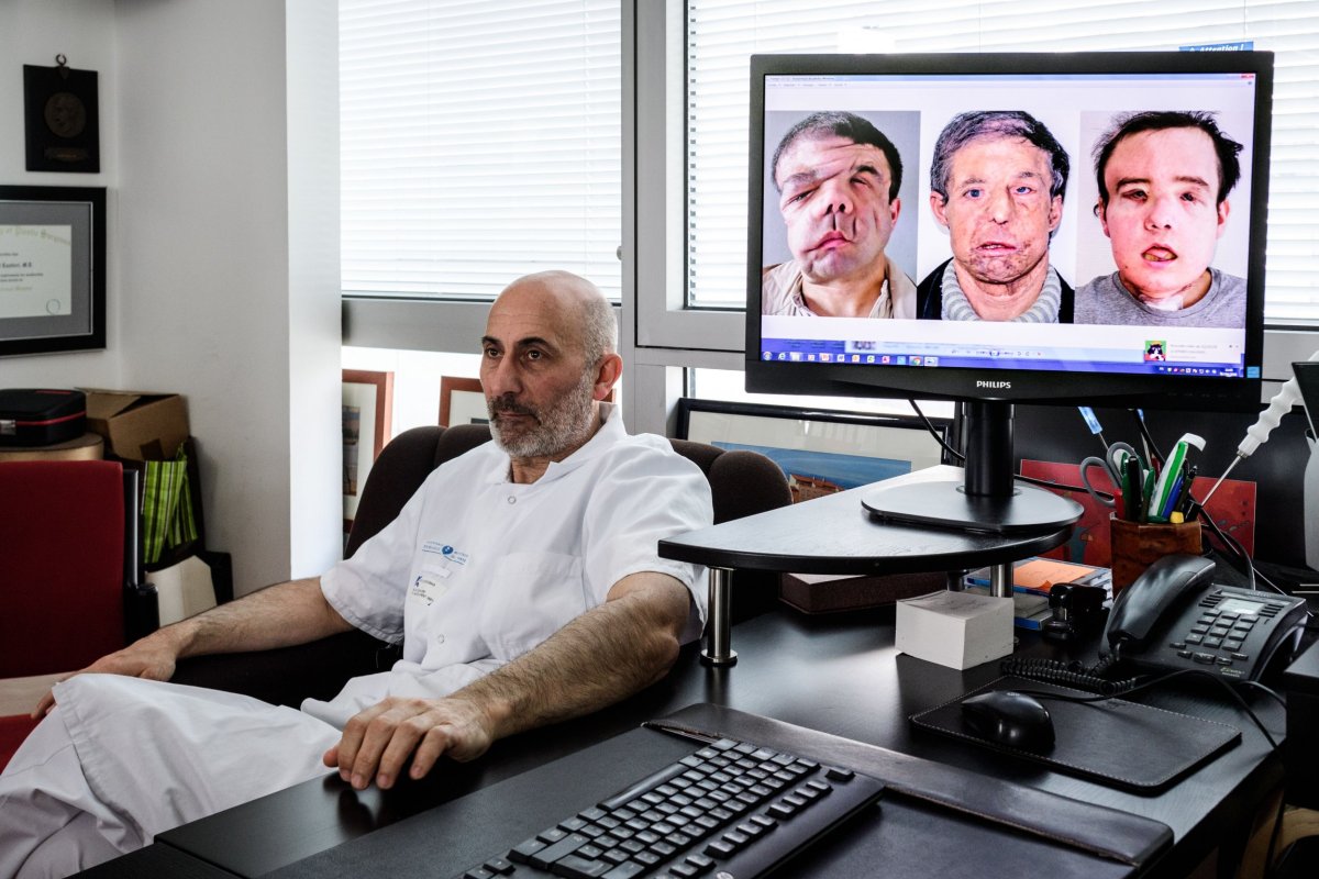 ‘Man With Three Faces’ Becomes First Ever Patient to Receive Two Face ...