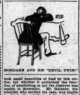 Edward Mordrake’s Mummified Head Photo Isn’t Real, Two-Faced Skull ...