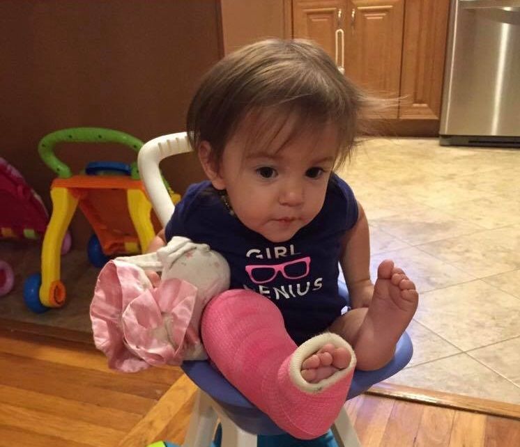 Mother Shares Photo of Toddler’s Broken Leg to Warn Against Common ...