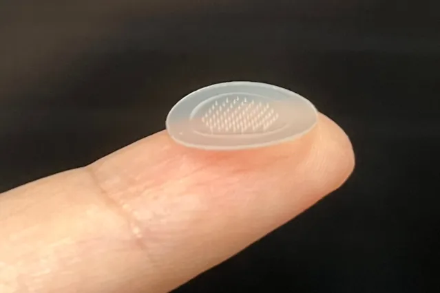 Scientists Invent Patch That Makes Pimples ‘Disappear’ Pain-Free - Newsweek