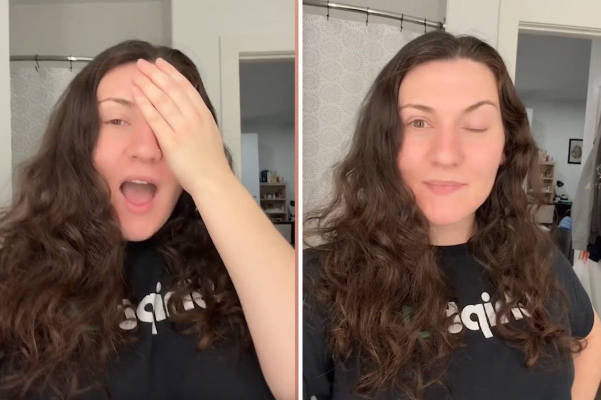 Woman gets Botox to treat migraines—but it goes horribly wrong - Newsweek