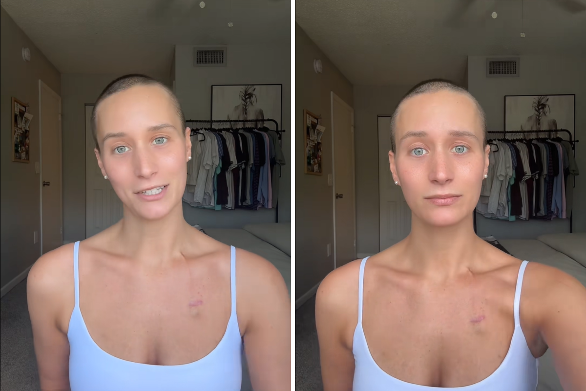 I Found a Lump on My Collarbone—the Diagnosis Turned My Life Upside ...
