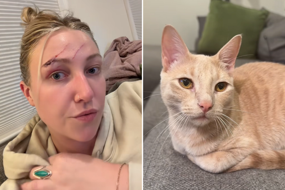Woman Left With Two Huge Cat Scratches on Face—Then Has Horror ...