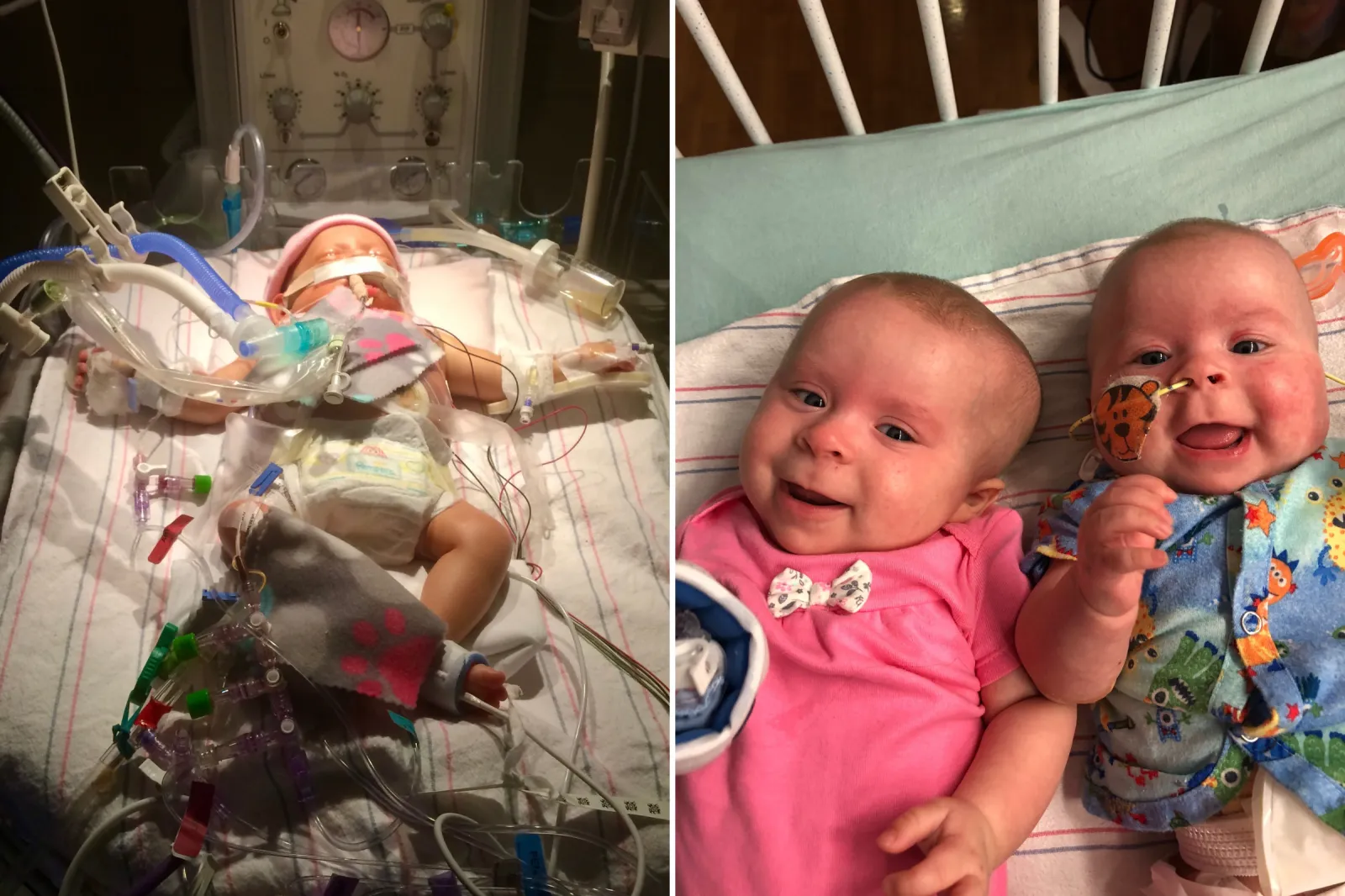 Newborn Twins Diagnosed With Cancer, Mom Reveals Test To Detect ...