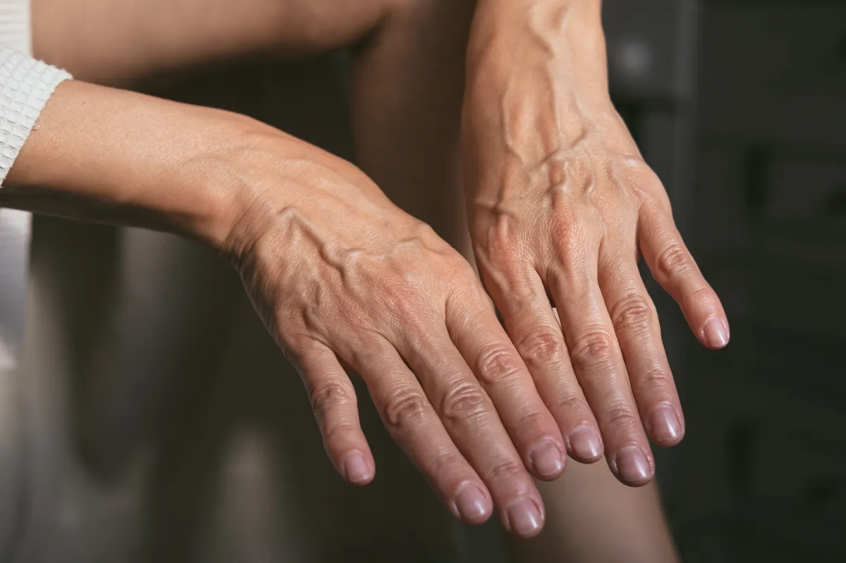 The Hidden Sign of Aging That Isn’t on Your Face—And How to Reverse It ...