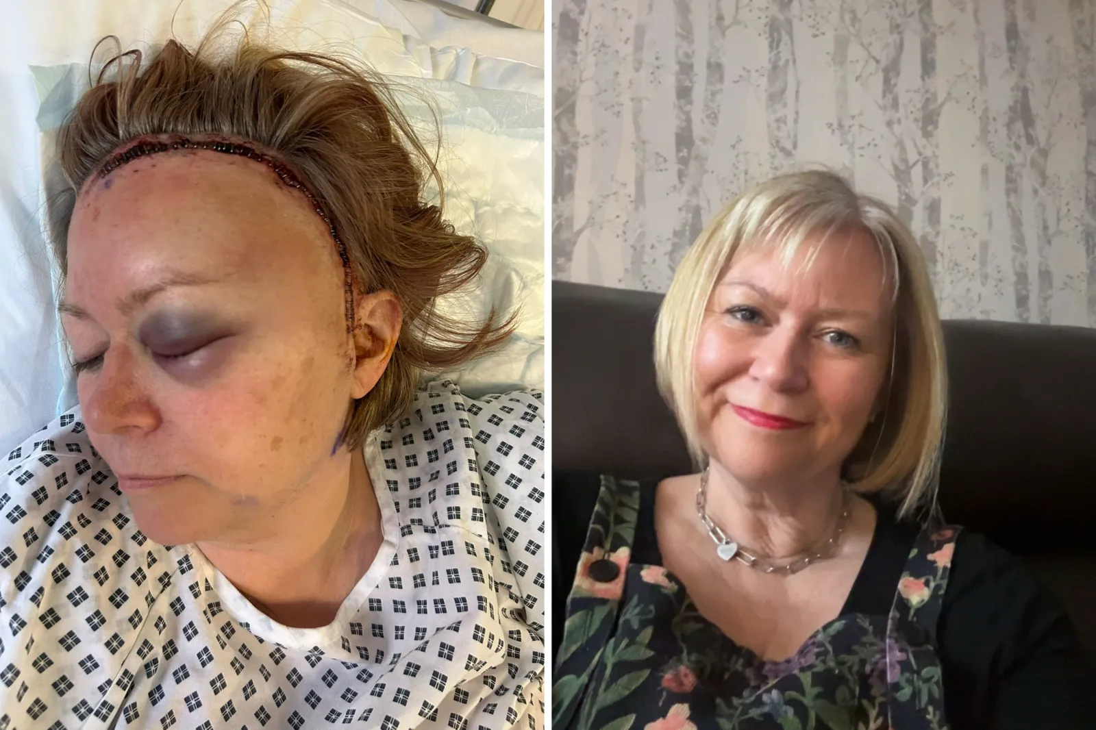 I Got a Sudden Headache—Seconds Later, I Was Fighting for My Life ...