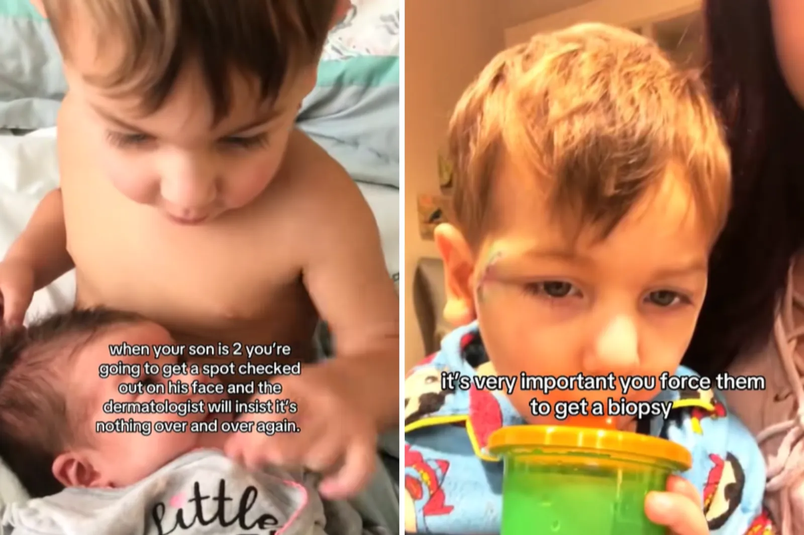 I Noticed a Spot on My Toddler’s Face, Trusting My Instincts Saved His ...